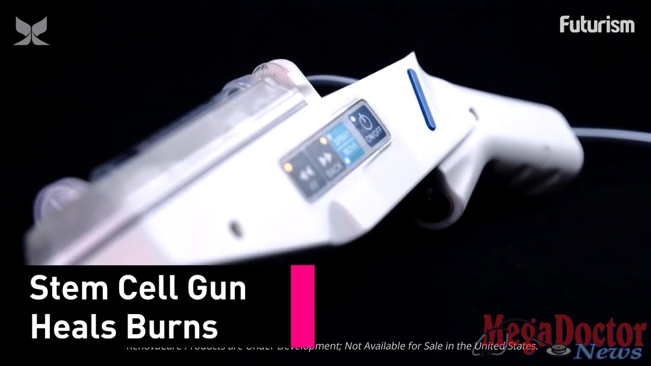 This gun can heal burns in just days - Mega Doctor News