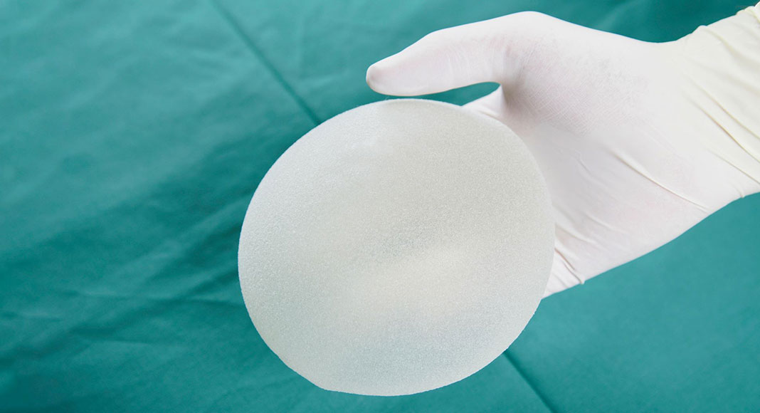 Allergan recalls worldwide its BIOCELL textured implants linked to a ...