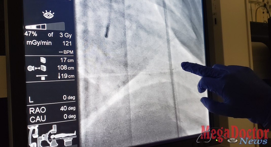 New Use of Technology Benefitting Cardio Patients at Valley Baptist ...