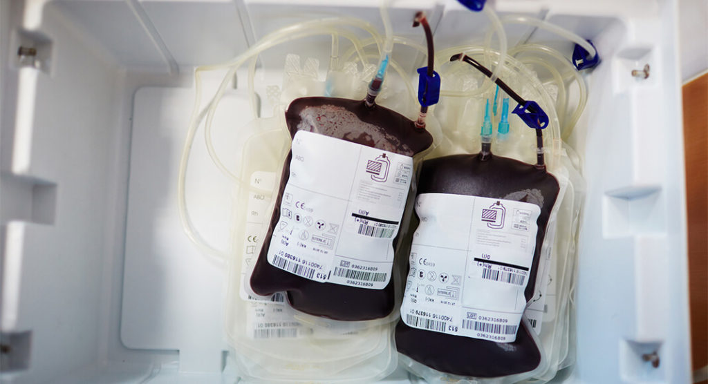 Reducing Need for Blood Transfusion during Heart Surgery Is Focus of ...