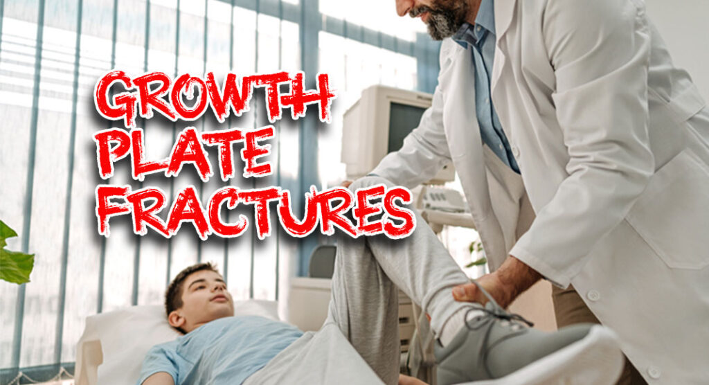 Growth plate fractures in children: Why they’re not as devastating as ...