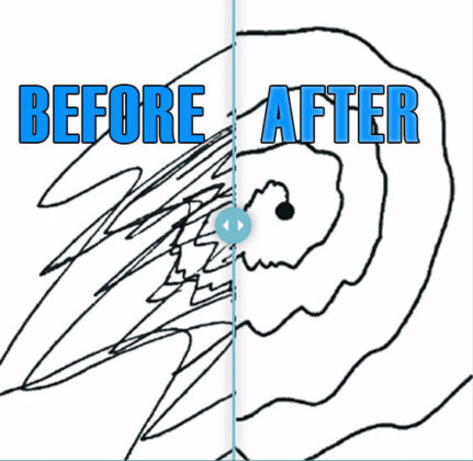 Cala Trio™; The first non-invasive personalized therapy for hand ...