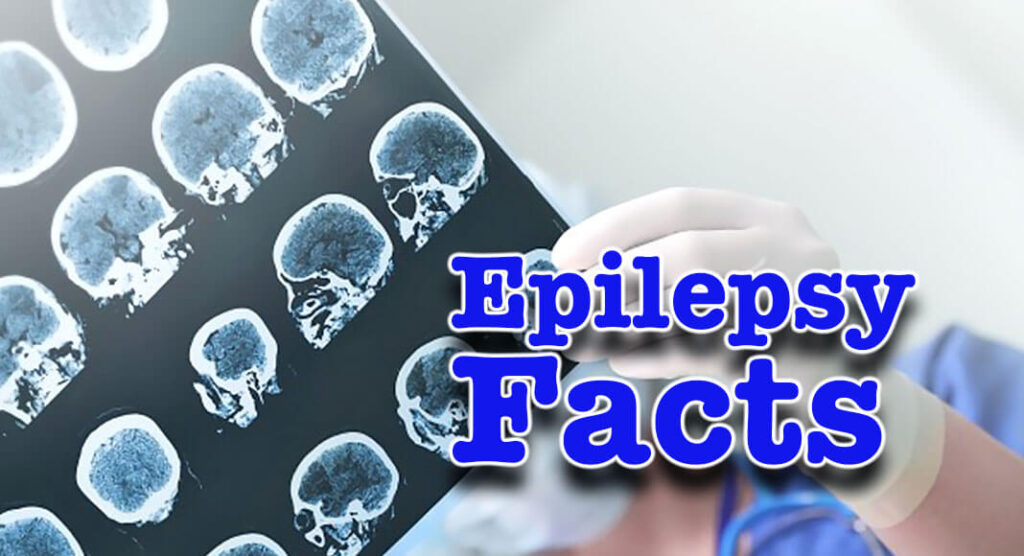 What you need to know about epilepsy - Mega Doctor News