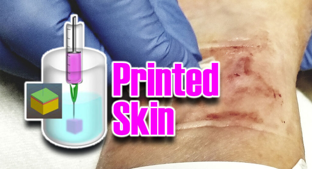 Printing Technique Creates Effective Skin Equivalent, Heals Wounds ...