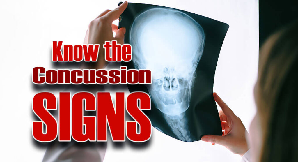 Know the Signs of Concussion - Mega Doctor News