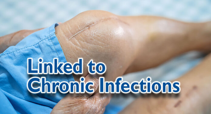 Chronic Infection Linked to Medical Devices - Mega Doctor News
