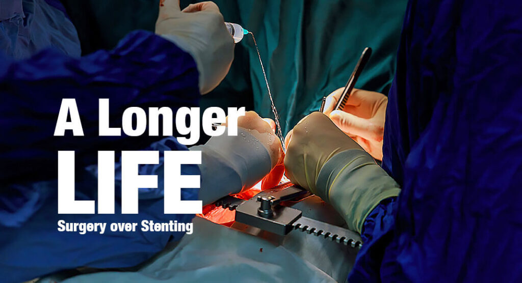 Coronary Artery Bypass Surgery over Stenting? - Mega Doctor News