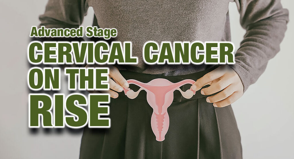 Advanced Stage Cervical Cancer on the Rise - Mega Doctor News