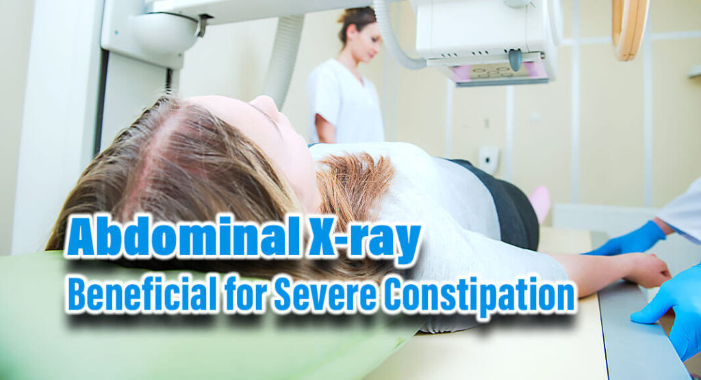 Constipation X-ray: Procedure, results, and treatment - Mega Doctor News