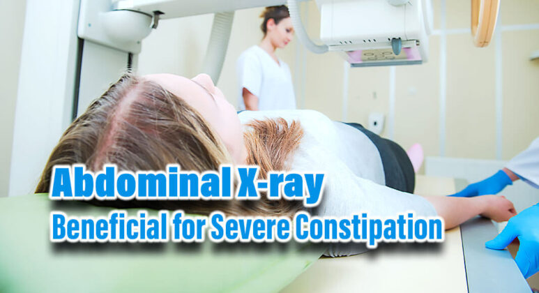 Constipation X-ray: Procedure, results, and treatment - Mega Doctor News