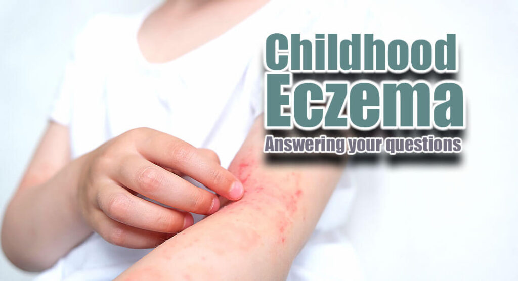 Q and A: Childhood Eczema - Mega Doctor News