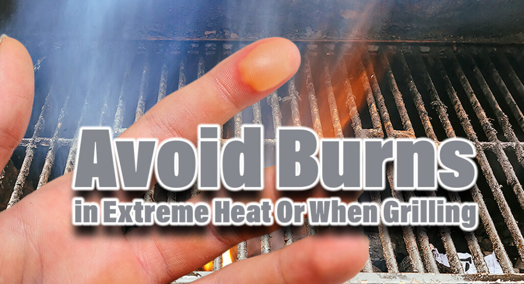 Avoid Burns in Extreme Heat or When Grilling - Mega Doctor News