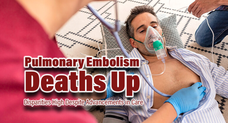 Pulmonary Embolism Deaths, Disparities High Despite Advancements in ...