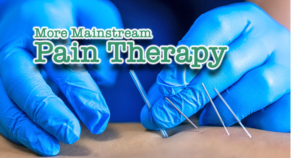 Acupuncture Becomes More Mainstream as Pain Therapy - Mega Doctor News