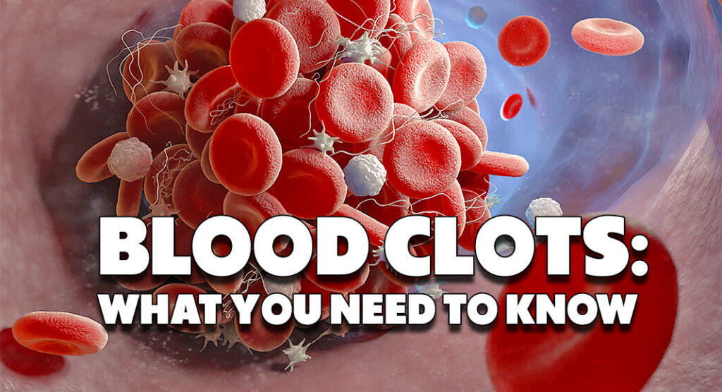 March is Blood Clot Awareness Month - Mega Doctor News
