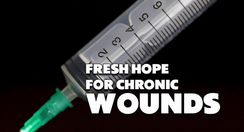 Fresh Hope For Chronic Wounds - Mega Doctor News