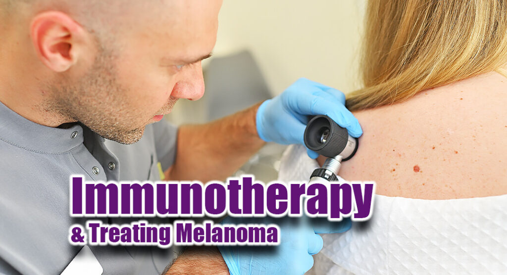 How New Immunotherapy is Helping to Treat Melanoma - Mega Doctor News