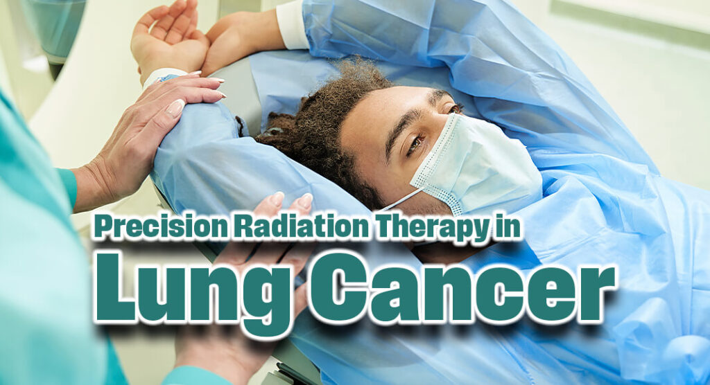 Study Supports Precision Radiation Therapy in Lung Cancer - Mega Doctor ...