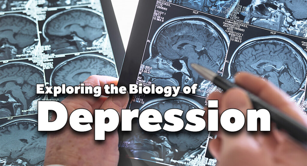 Brain Scan Depression