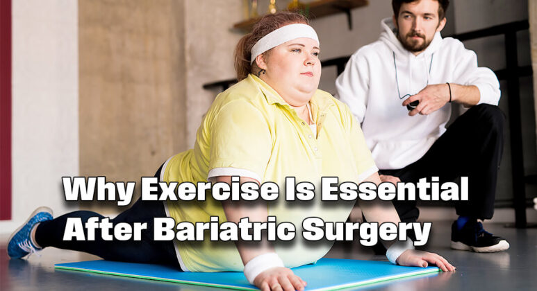 Why Exercise Is Essential After Bariatric Surgery - Mega Doctor News