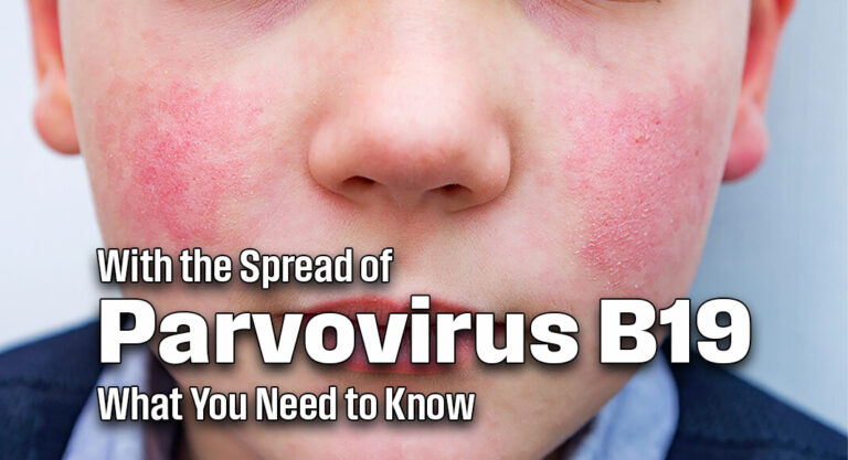 With the Spread of Parvovirus B19: What You Need to Know - Mega Doctor News