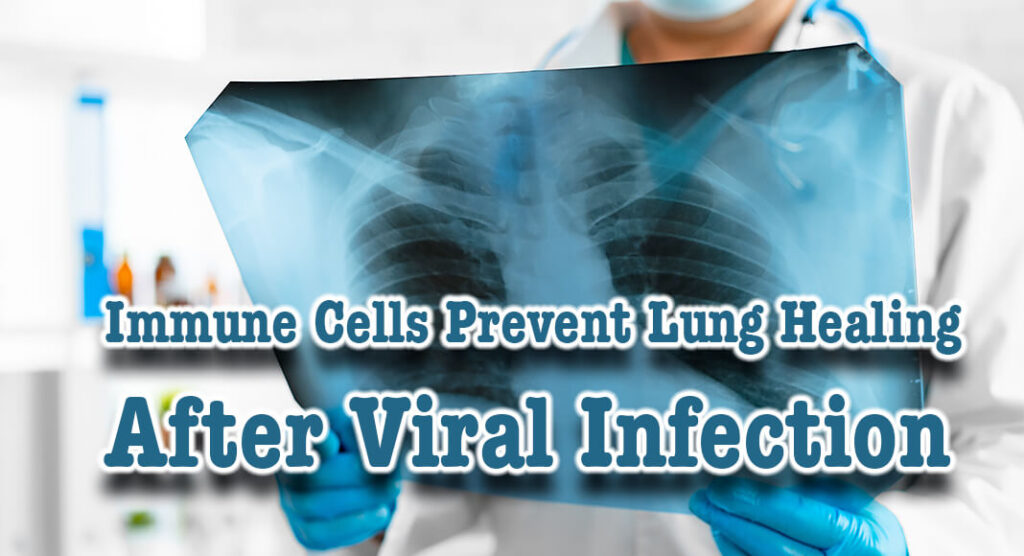 Immune Cells Prevent Lung Healing After Viral Infection - Mega Doctor News