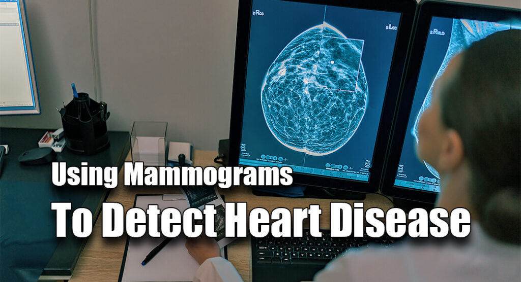 Using Mammograms to Detect Heart Disease - Mega Doctor News