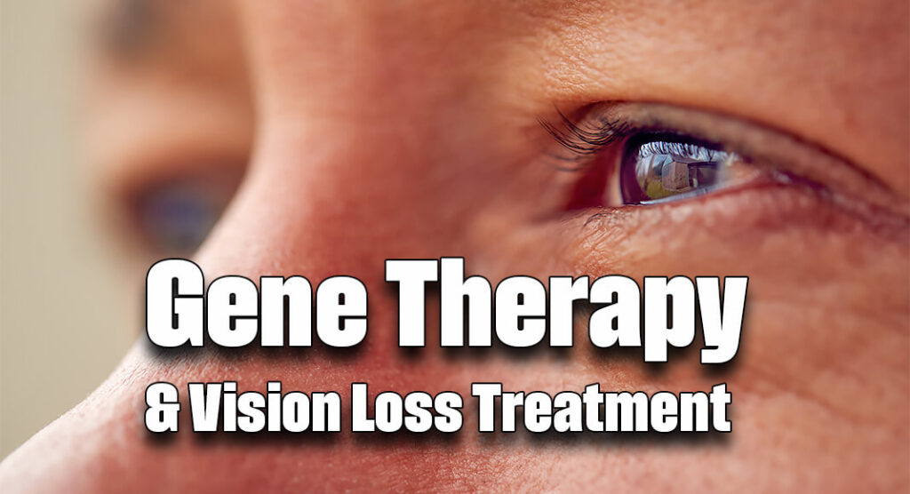 Is gene therapy the next big step in vision loss treatment? - Mega ...