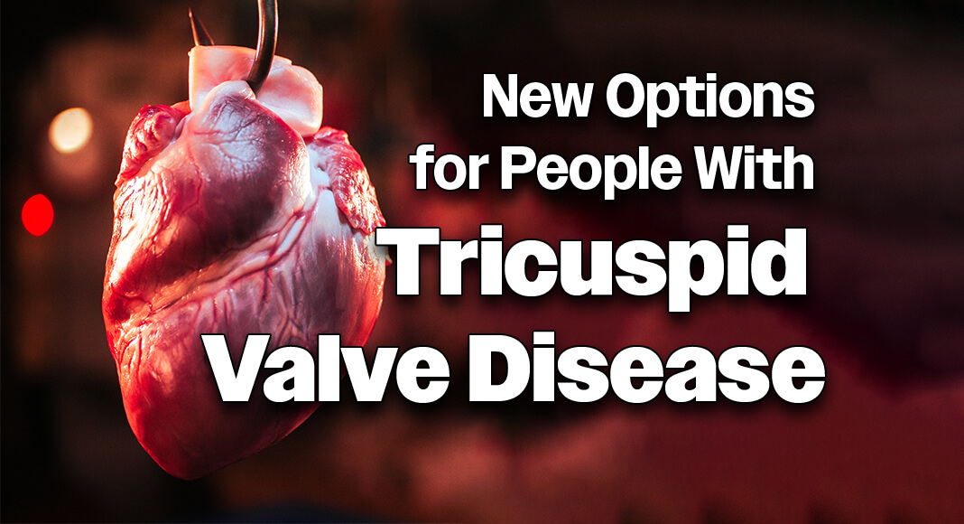 New Options for People with Tricuspid Valve Disease - Mega Doctor News