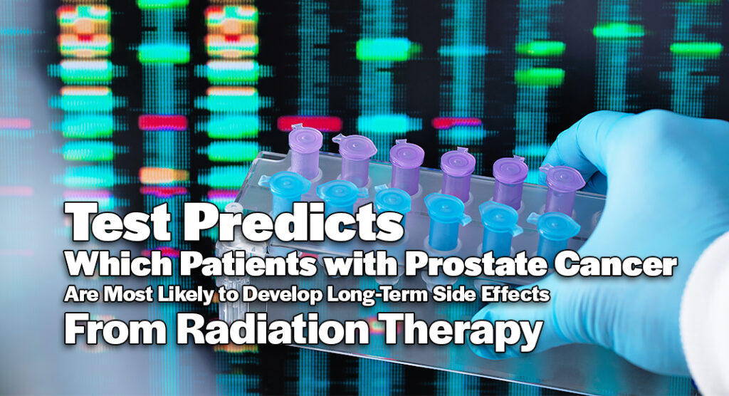Test Predicts Which Patients with Prostate Cancer Are Most Likely to ...