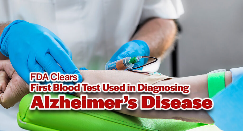 FDA Clears First Blood Test Used in Diagnosing Alzheimer’s Disease ...