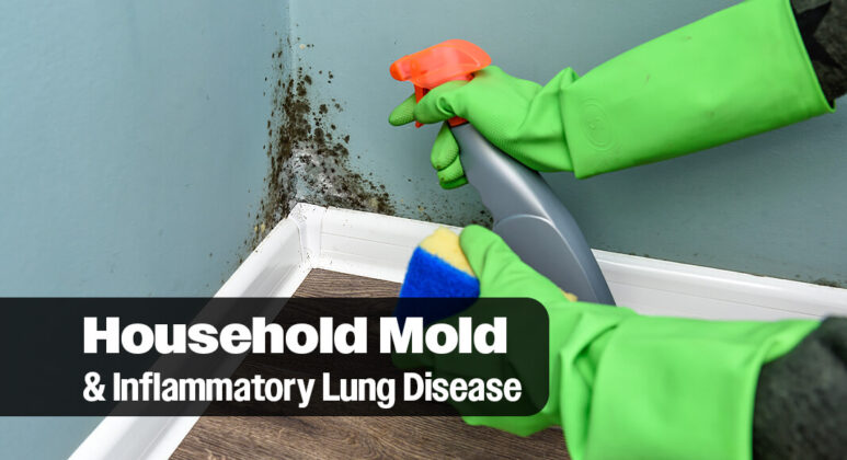 Household Mold Linked to Inflammatory Lung Disease - Mega Doctor News