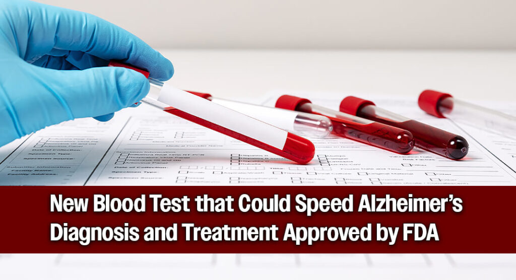 FDA Clears New Blood Test that Could Speed Alzheimer’s Diagnosis and ...