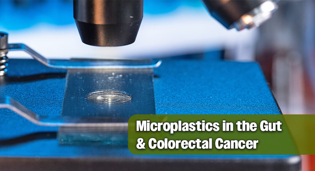 Microplastics in the Gut Tied to Patterns Seen in Colorectal Cancer ...
