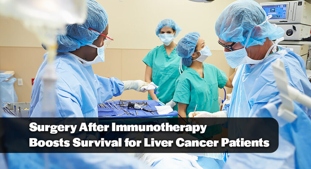 Surgery After Immunotherapy Boosts Survival for Liver Cancer Patients ...